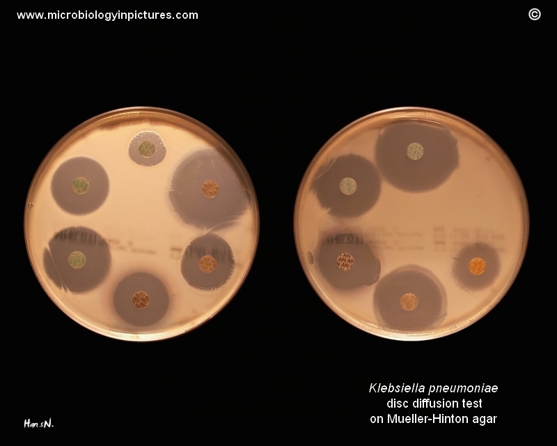 Klebsiella Pneumoniae Antibiotic Sensitivity Test at Sean Chaffey blog Klebsiella Pneumoniae Antibiotic Sensitivity Test at Sean Chaffey blog